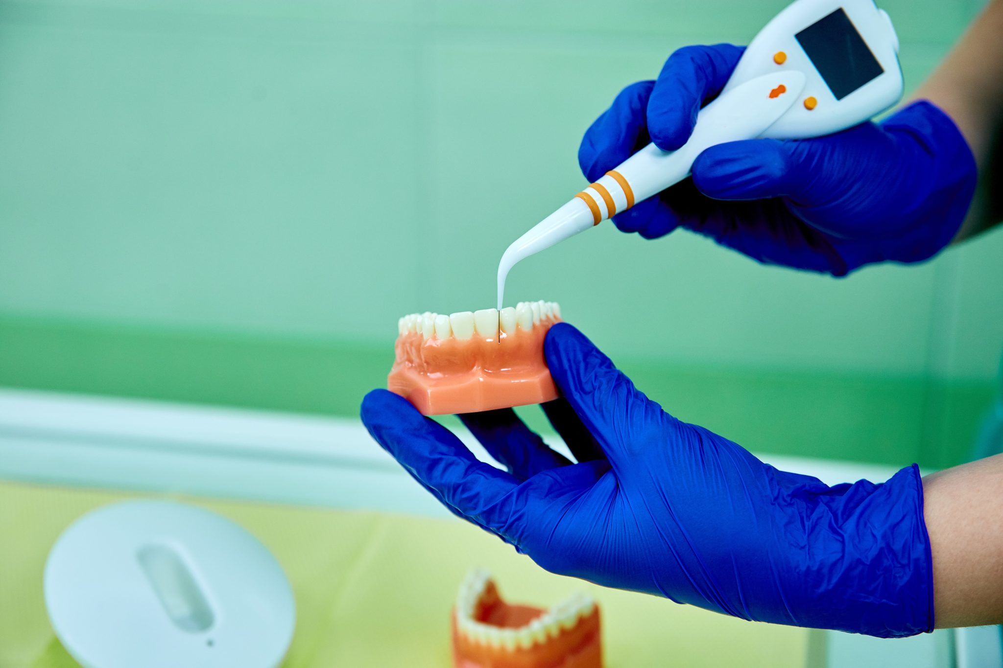 Experience Best Dental Extraction Solutions At CiDentist