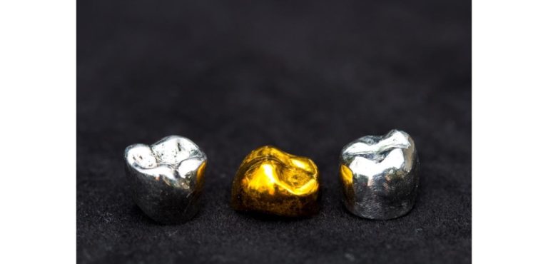 Discover Best Dental Fillings Specialist At CiDentist