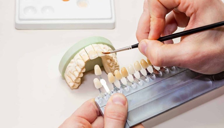 Mastering Smiles: Types Of Dental Restoration Revealed | CiDentist